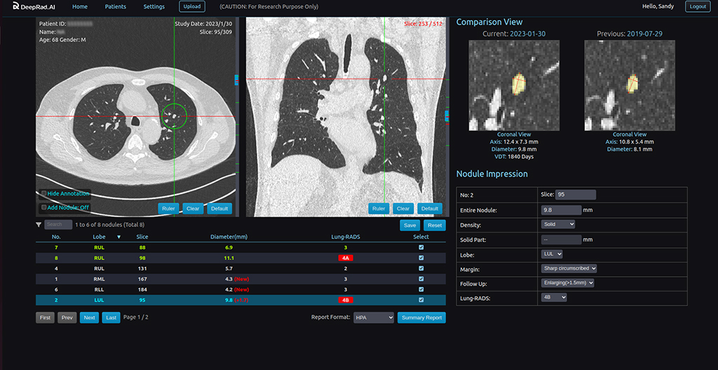 One LDCT Scan for Both Heart and Lung Screening! - DeepRad.AI