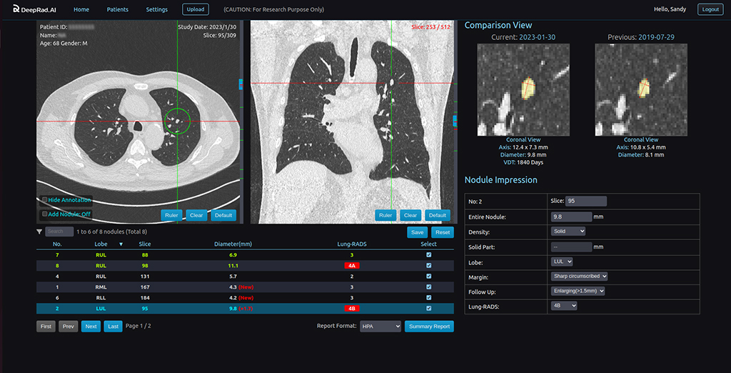AI-Powered Screening for Lung Cancer and Cardiovascular Calcification ...